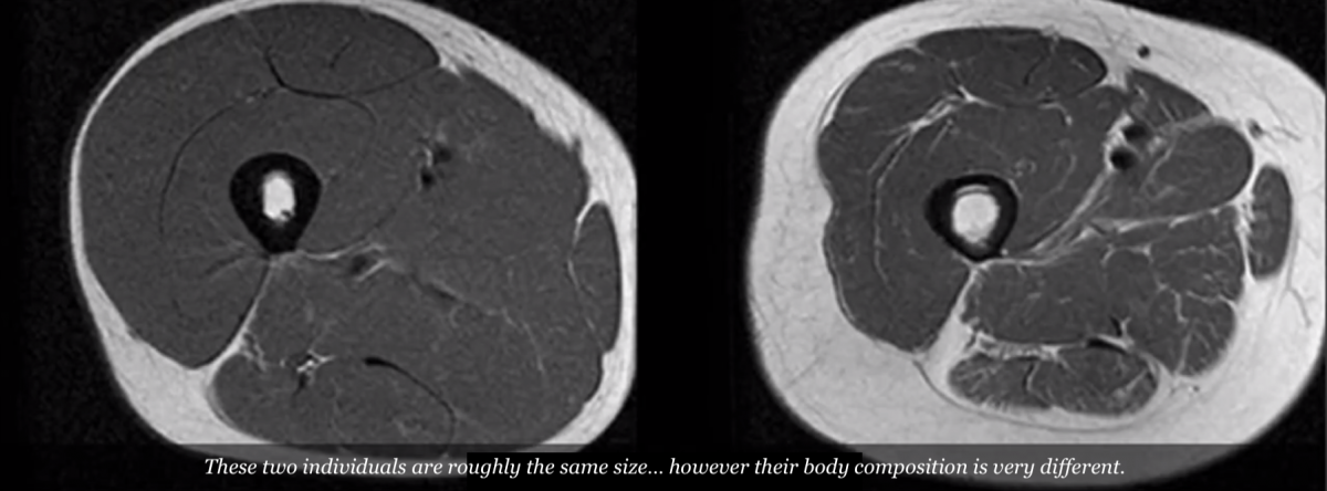 The Truth About Fat, Part 1 | TLS Blog
